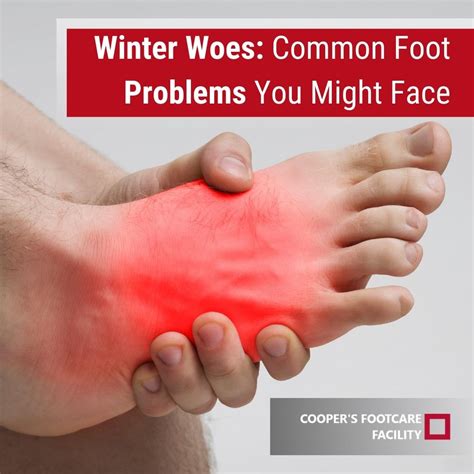 Chilblains Frostbite Coopers Footcare Facility