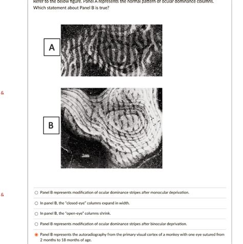 Refer To The Below Figure Panel A Represents The Normal Pattern Of Ocular Dominance Columns