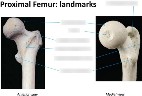 Diagram Of Proximal Femur Quizlet