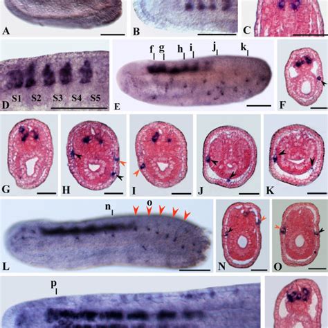 Amphisyn Expression In Amphioxus Larvae All Embryos Are Oriented With Download Scientific