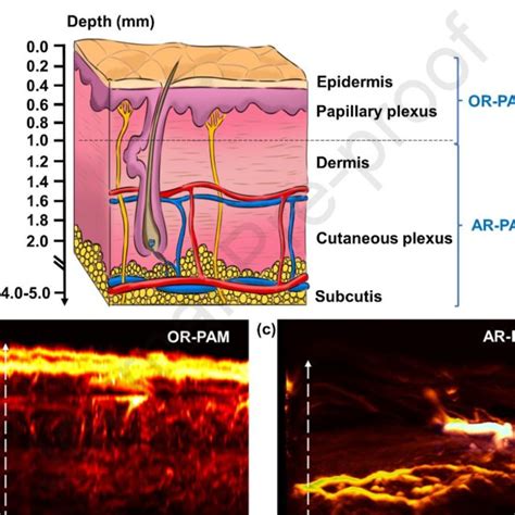 Photon Propagation Regimes In Soft Tissue And The Penetration Limits Of