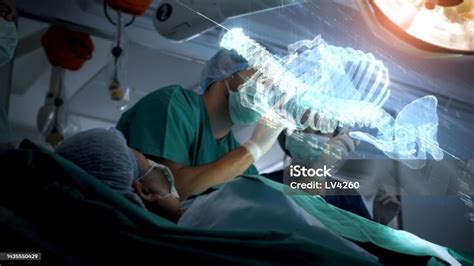 홀로그램 디스플레이를 통한 생물 의학 척추 진단 및 치료 절차 진행 병원에 대한 스톡 사진 및 기타 이미지 병원 사람들 사진 이미지 Istock