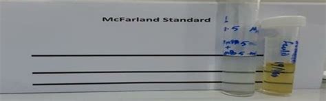 Mcfarland Turbidity Test Download Scientific Diagram
