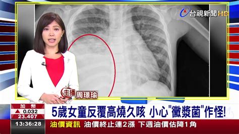5歲女童反覆高燒久咳 小心「黴漿菌」作怪！ Youtube