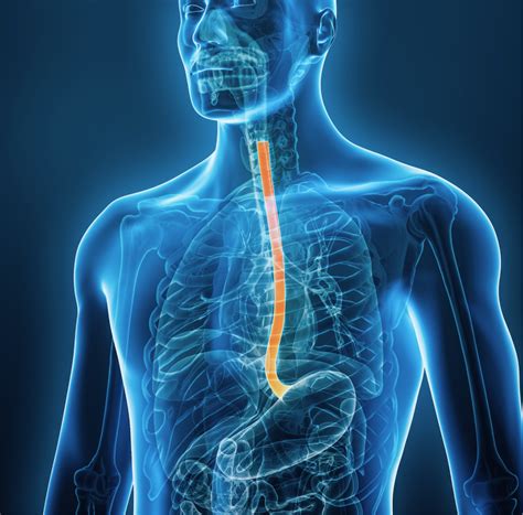 Silent Reflux Symptoms Causes And Relief Larri