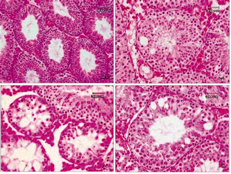 Antioxidant Effects Of Selenium On Sperm Parameters And Testicular Structure In Babe And Aged Mice