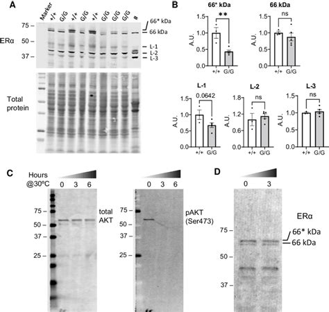 The Upper 66 Kda In The Liver Is Resistant To Spontaneous Download Scientific Diagram