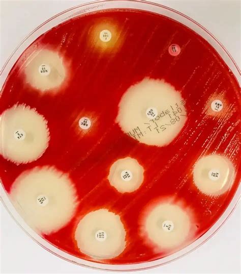 Serratia Marcescens