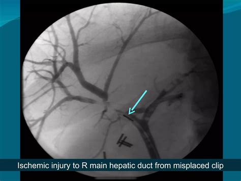 Endoscopy In Gastrointestinal Oncology Slide 12 J Baillie