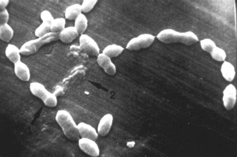 BSCI Pathogenic Microbiology Streptococcus