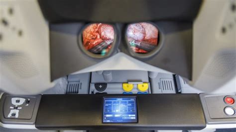 使用全卷积网络在 Transformer 模型中模拟注意力机制 Nvidia 技术博客