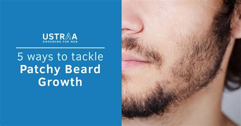 Ways To Tackle Patchy Beard Growth