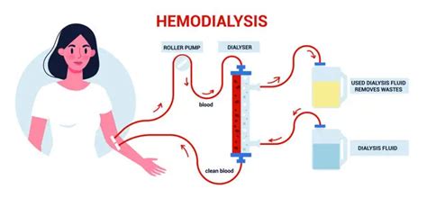 Dialysis Options Hemodialysis Vs Peritoneal Dialysis Livasa