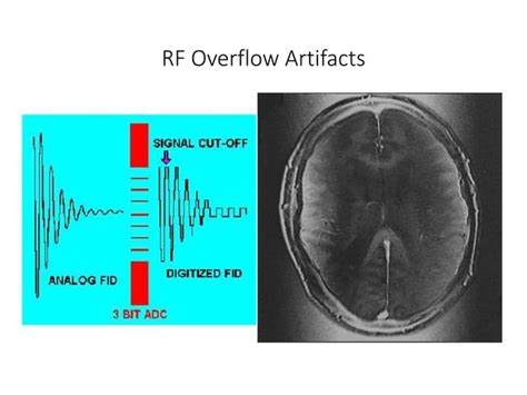 Mri Artifacts Introduction Classification Types Ppt
