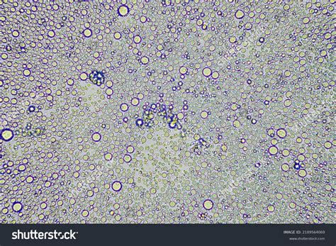 Bacterial Cell Under Electron Microscope