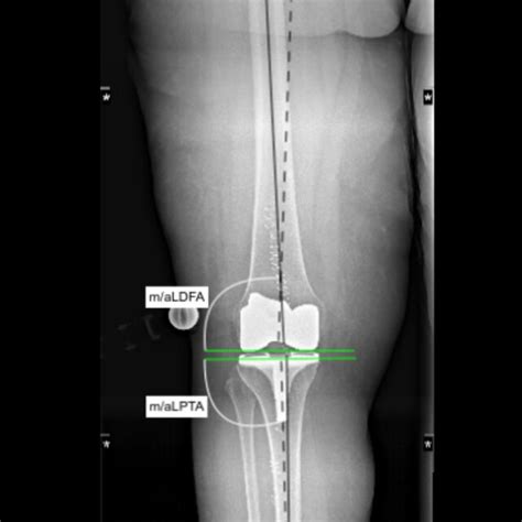 Imaging References Illustrating The Main Axes And Reference Angles
