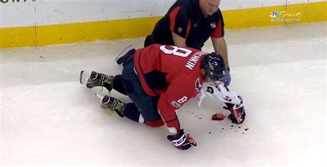 Alex Ovechkin Takes Puck To Face Bleeds All Over The Ice Rmnb