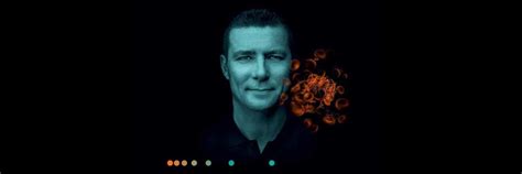 Innovance D Dimer Assay Siemens Healthineers