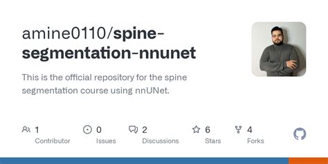Spine Segmentation Nnunet Utils Dataset Py At Main Amine0110 Spine