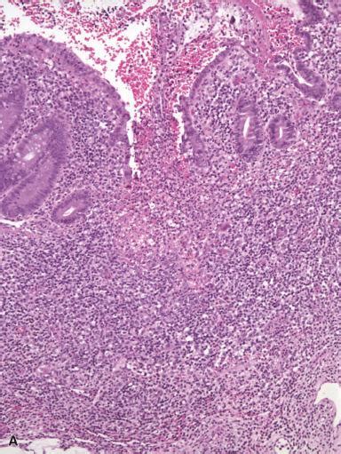 Appendix Clinical Tree