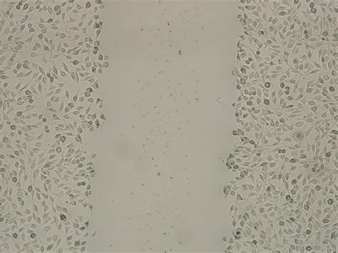 Analysis Of Scratch Assay Using Imagej R Labrats