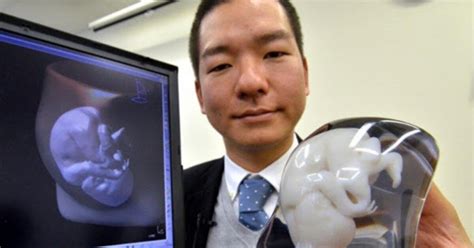 Japanese Firm Offers 3d Model Of Foetus