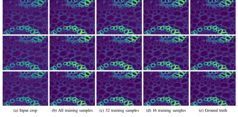 Generalizable Denoising Of Microscopy Images Using Generative