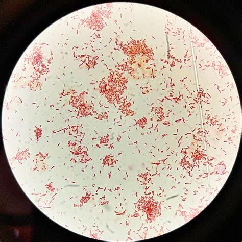 Escherichia Coli Gram Stain E Coli Bacteria Gram Stain N Flickr