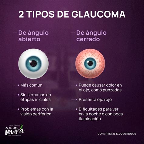 En Existen Dos Tipos De Glaucoma Y Para Ambos La Mejor Prevención Es