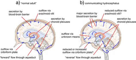 View Of Net CSF Flow Pattern In Normal Adult Brain Compared With That Download Scientific