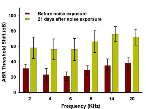 Abr Threshold Shift Measured At Different Frequencies Before And 21