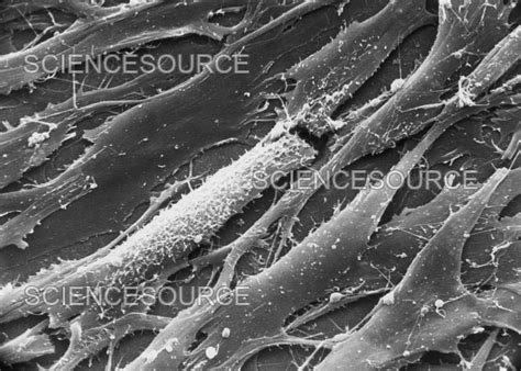 Fibroblasts Sem Stock Image Science Source Images