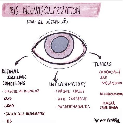 Iris Ophthalmology Notes And Synopses