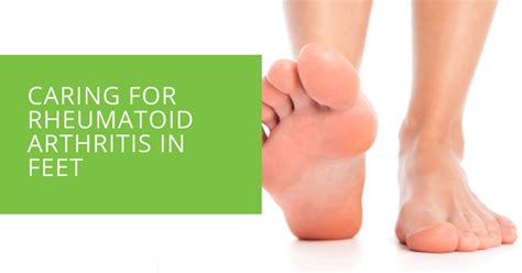 Rheumatoid Arthritis Feet