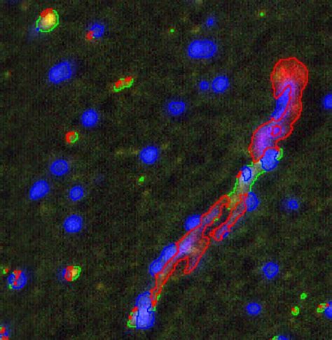 Are Multiple Annotations On A Pixel Via Qupath Possible Image Analysis Imagesc Forum