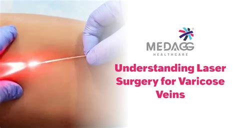 Laparoscopic Salpingectomy A Complete Guide To Treatment Benefits And Alternatives Medagg