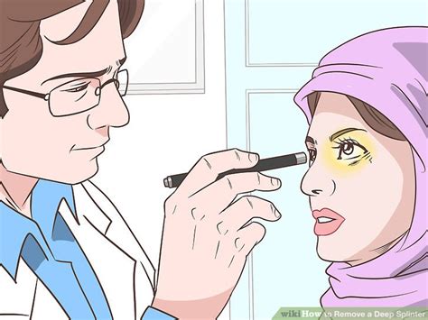 Ways To Remove A Deep Splinter WikiHow