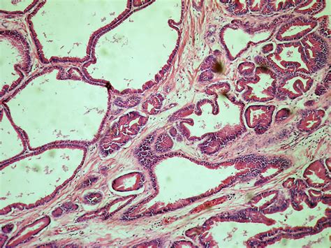 Histologia Ufjf Lâmina 36 Próstata