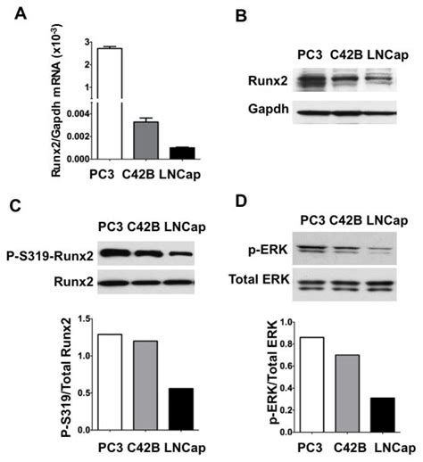Role Of Runx2 Phosphorylation In Prostate Cancer And Association With