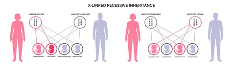 Premium Vector X Linked Recessive Inheritance