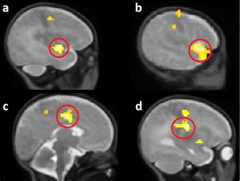 Psychophysiological Interaction Of The Left And Right Primary Auditory Download Scientific