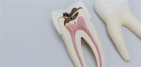 Rotary Or Reciprocating Endodontics That Is The Question…