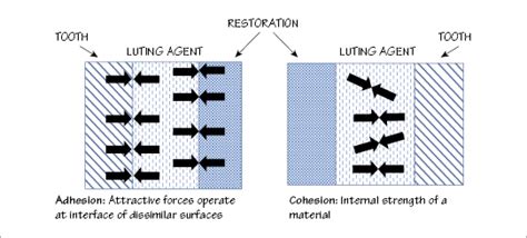 Adhesion And Cohesion Pocket Dentistry