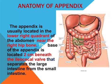 Appendicitis Overview Pptx