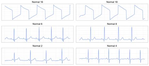 Github Jmotifsax Java Implementation Of Sax Hot Sax And Emma