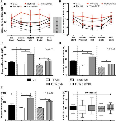 Snr And Cnr Analysis For All Stents A D Constant Snr And Cnr Remained Download Scientific