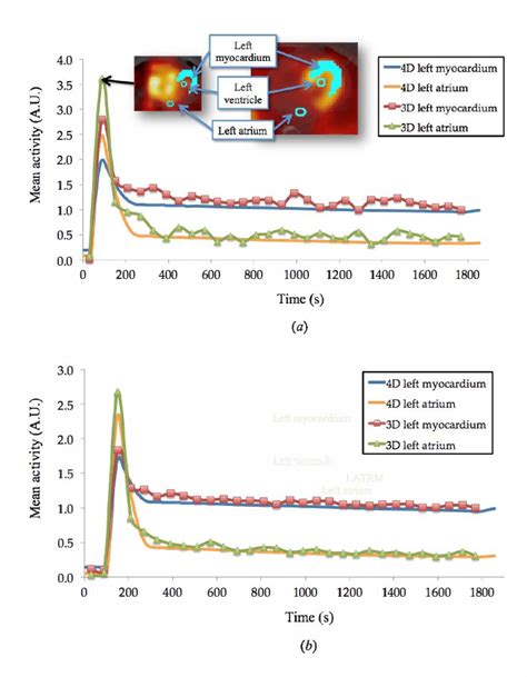 Figure 2 From A Dynamic Single Photon Emission Computed Tomography