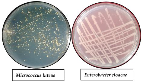 Enterobacter Cloacae