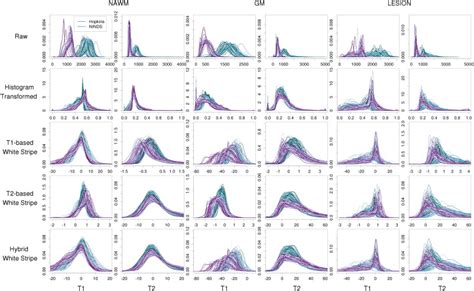 histograms of intensities before and after normalization by tissue type