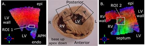 Anatomical Loci Of The Samples And Rois The Central Picture Shows The